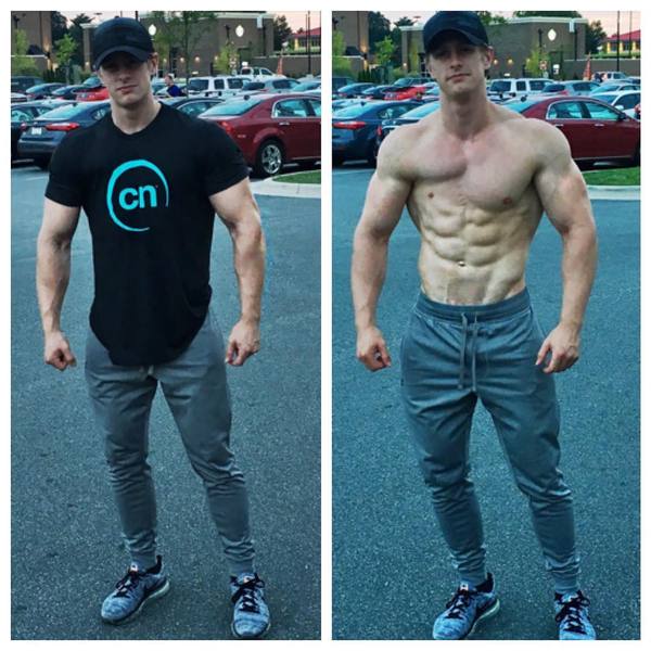 Gunnar Anderson - парень, который родился без правой большой грудной ...